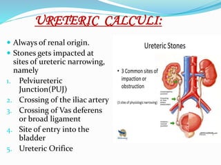 Stones & tumours of kidney ppt.- by Smriti singh | PPT