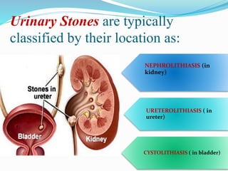 Stones & tumours of kidney ppt.- by Smriti singh | PPT