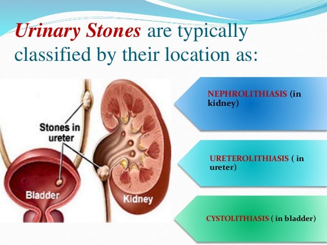 Stones & tumours of kidney ppt.- by Smriti singh
