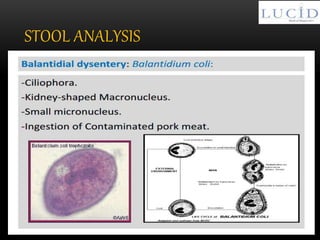 Stool analysis | PPTX