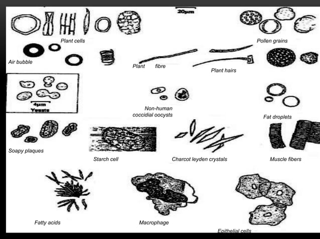 Stool analysis | PPT