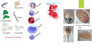 Stool Analysis Interpretation | PPTX