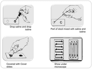 stool examinati55on.pptx