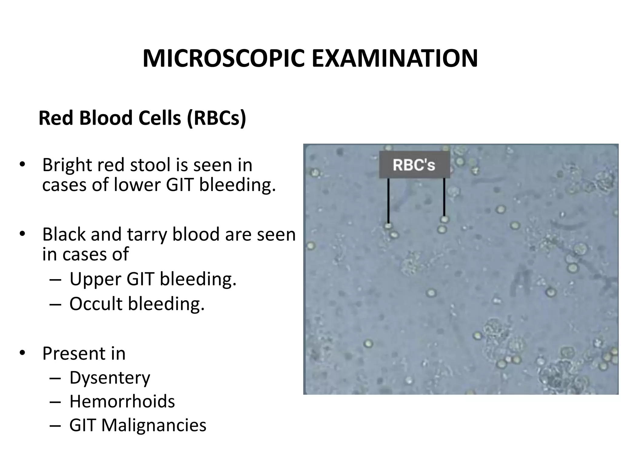 Stool Examination | PPTX