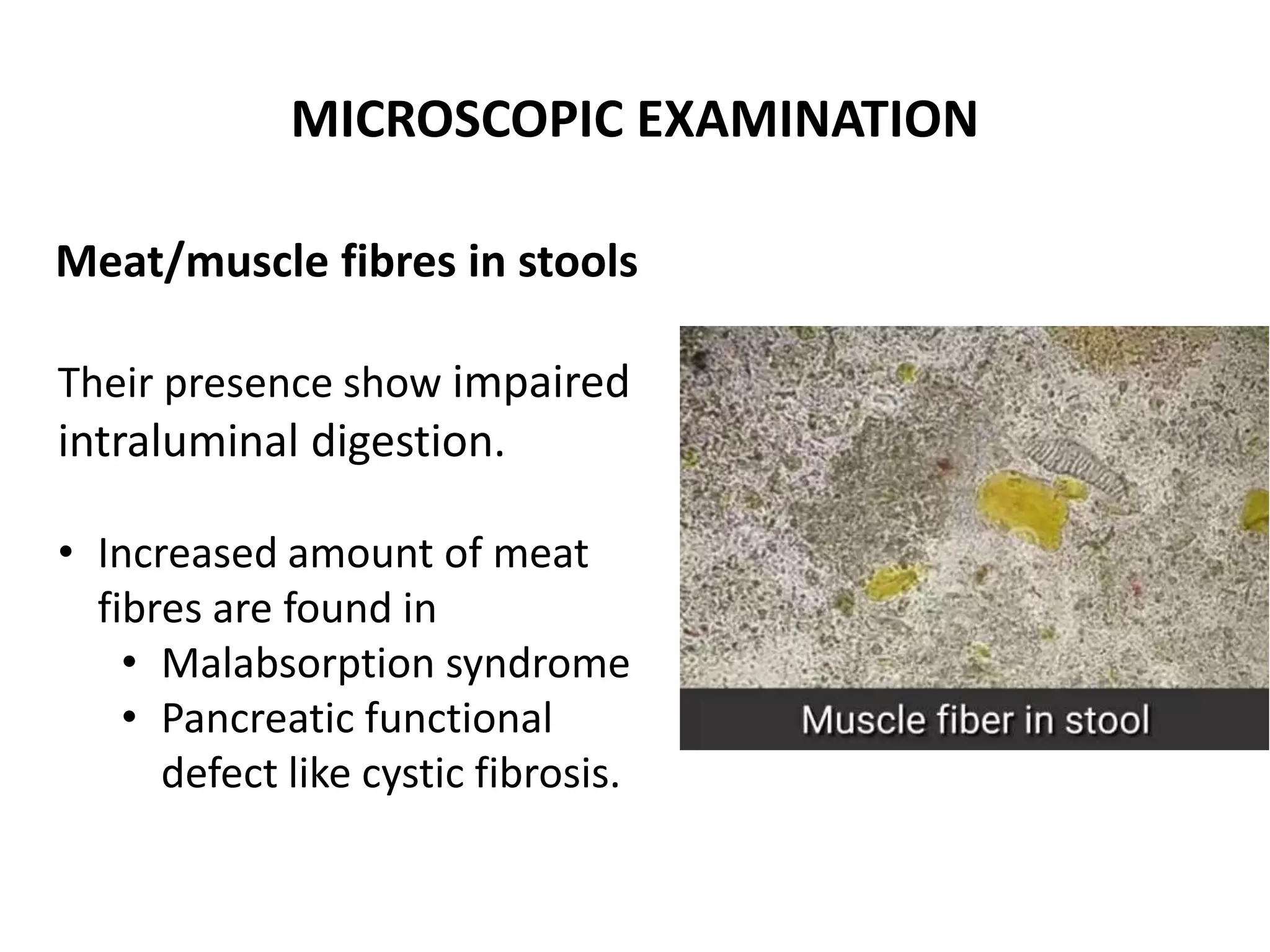 Stool Examination | PPTX
