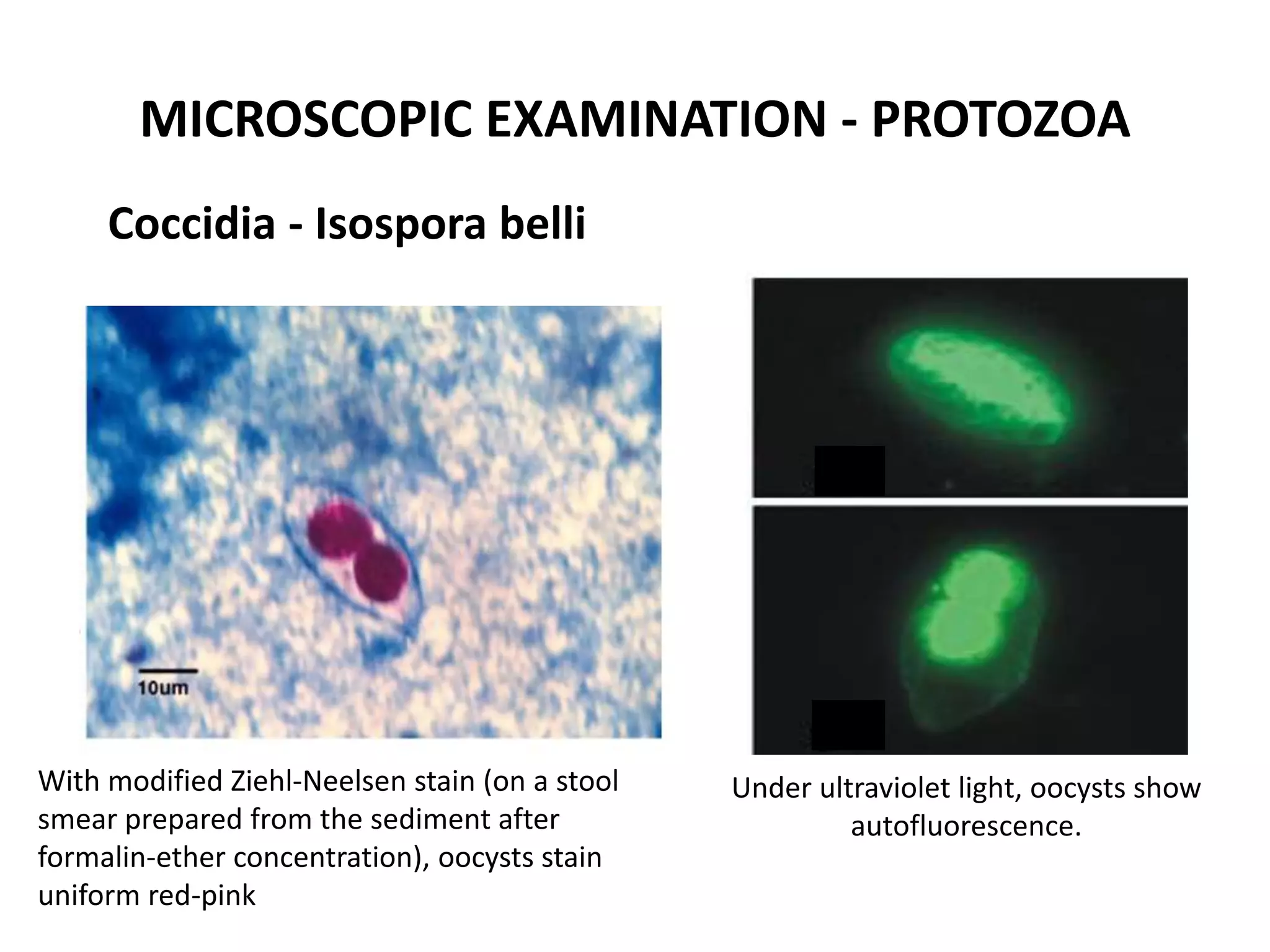 Stool Examination | PPTX
