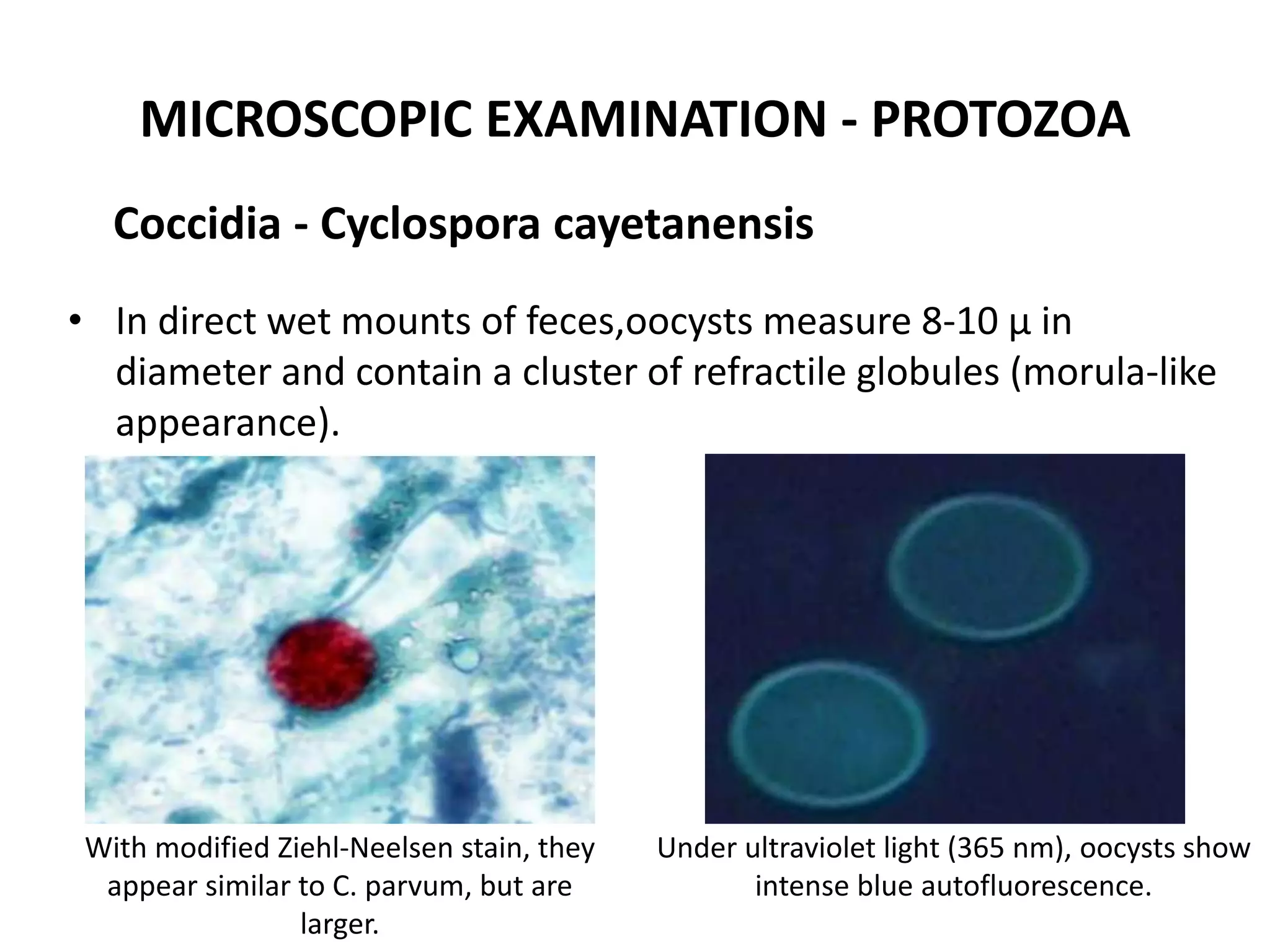 Stool Examination | PPTX