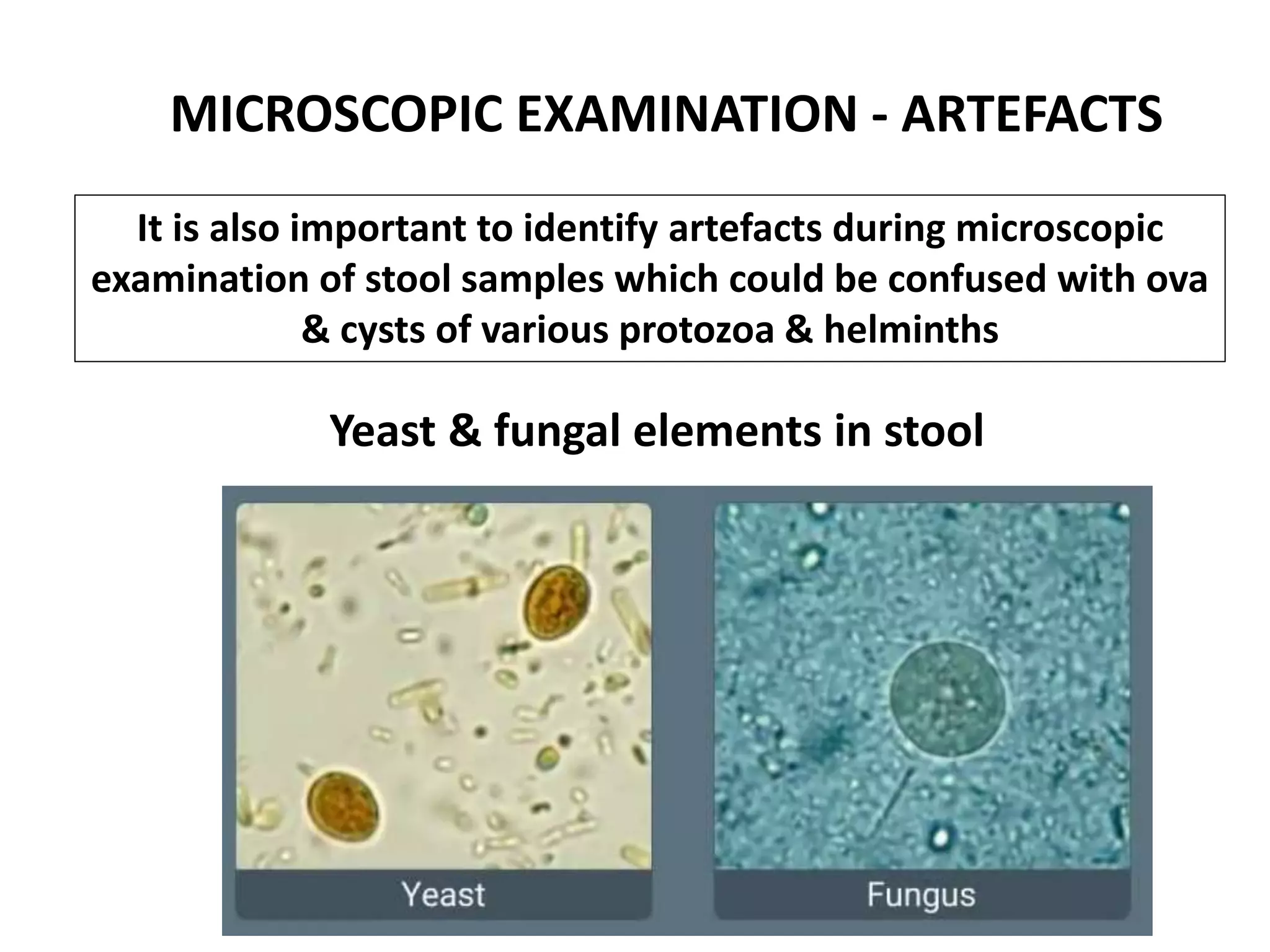 Stool Examination | PPTX