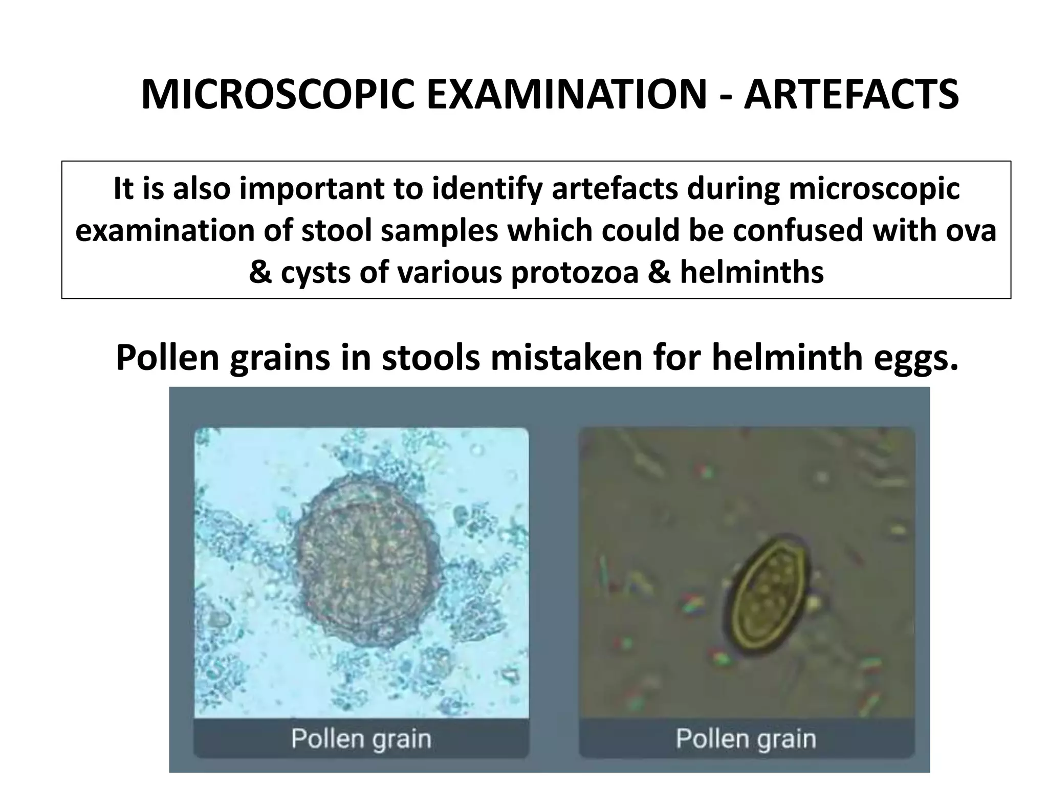 Stool Examination | PPTX