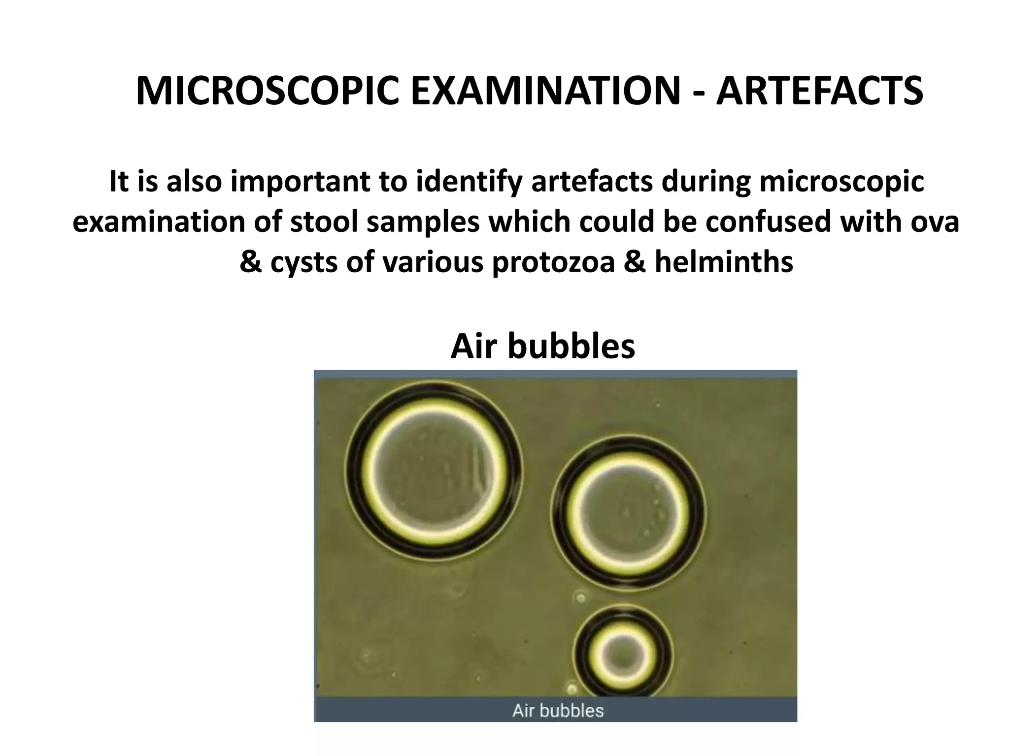 Stool Examination | PPTX