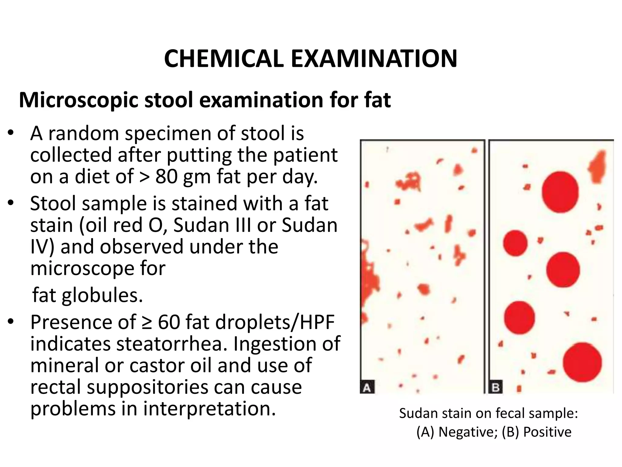 Stool Examination | PPTX