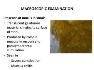 Mucoid Diarrhea