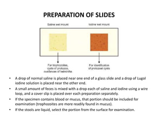 Yellow Watery Stools In Adults