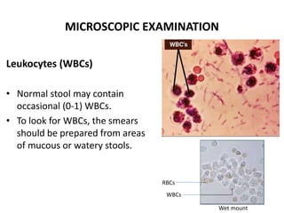 Fecal Wbc Prep With Stain