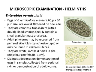 Enterobius Vermicularis In Stool