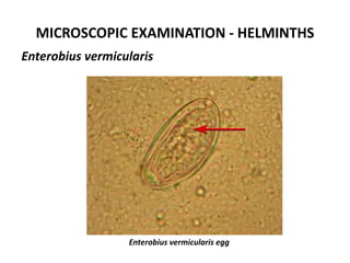 Enterobius Vermicularis In Stool