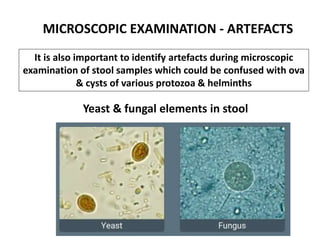 Yeast Clumps In Stool