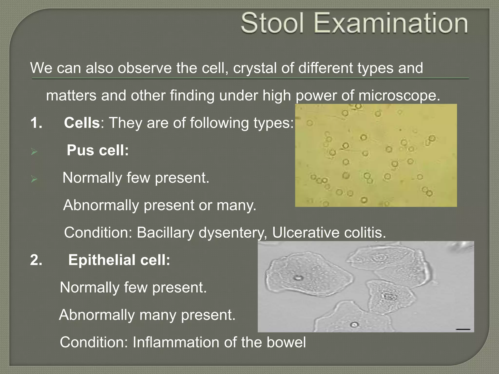 Stool examination | PPTX | Digestive Disorders | Diseases and Conditions