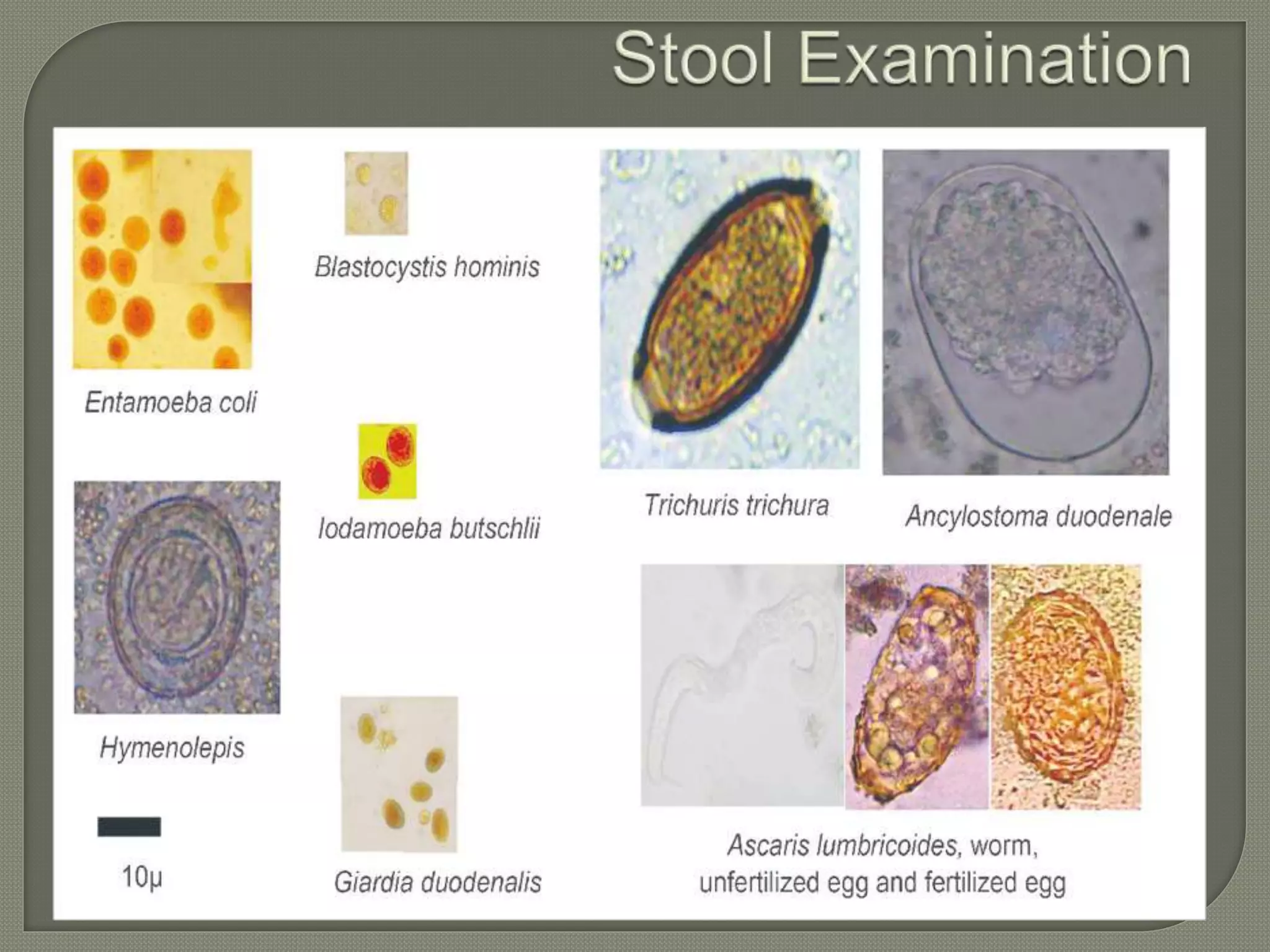 Stool examination | PPTX