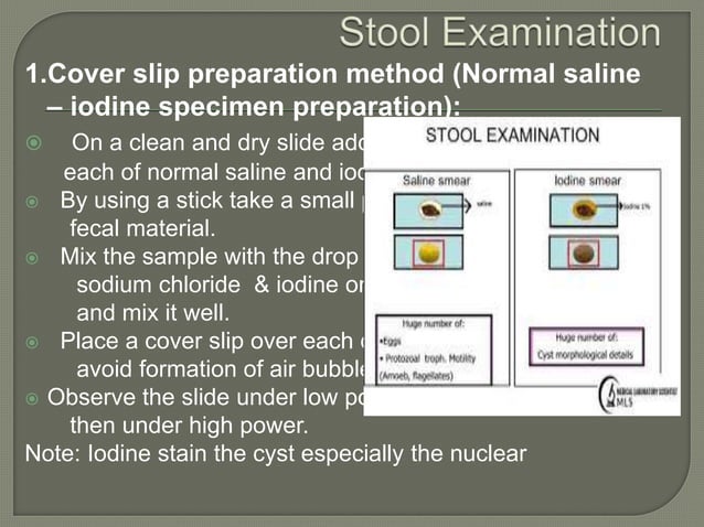Stool examination | PPTX | Digestive Disorders | Diseases and Conditions