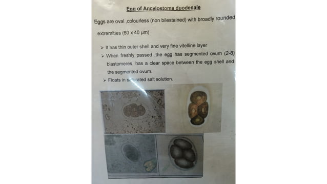 Stool examination microbiology mbbs 2nd .pptx