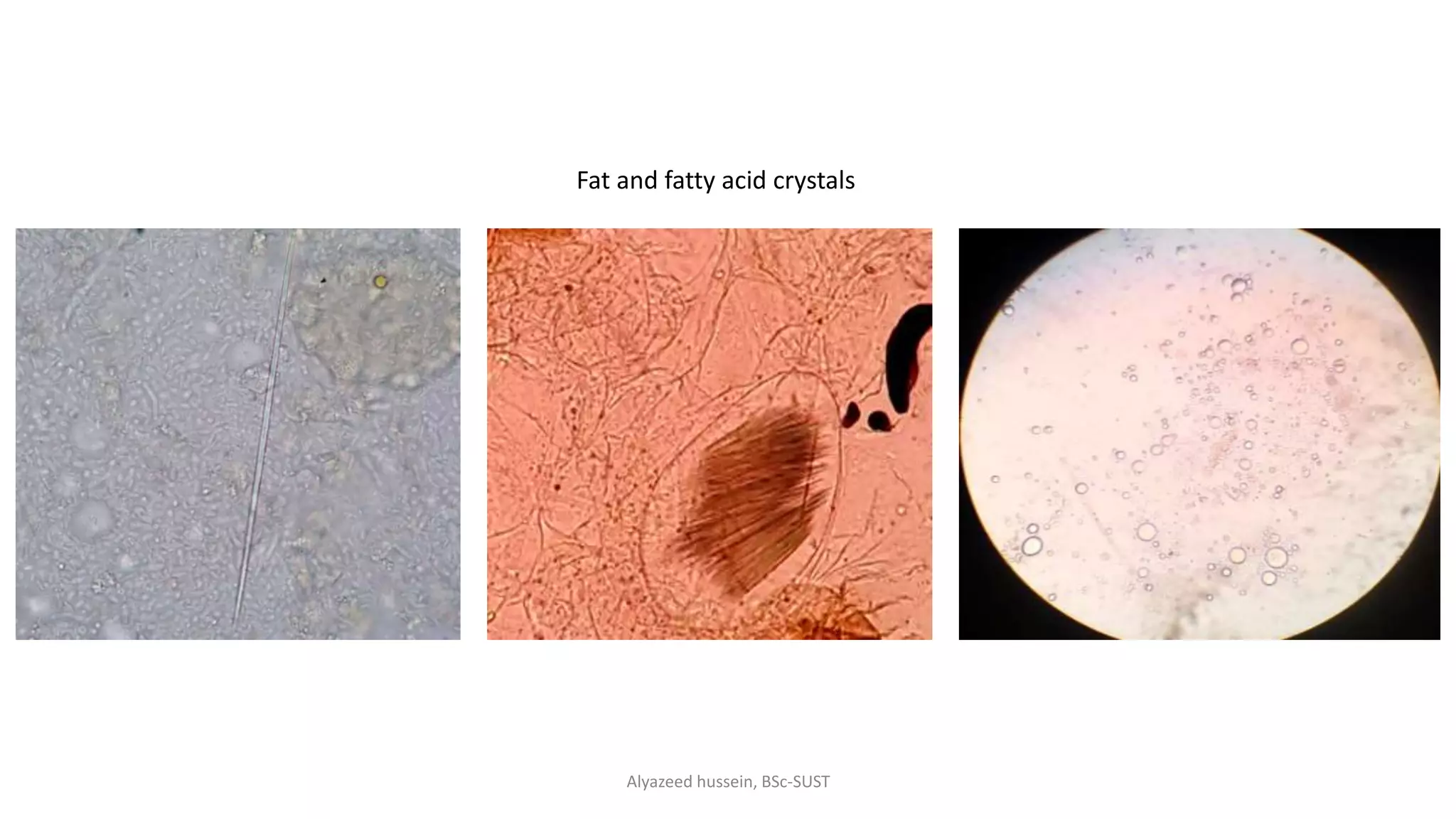 Stool analysis | PPTX