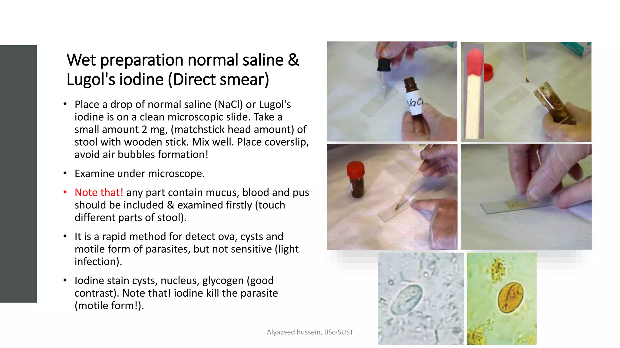 Stool analysis | PPTX