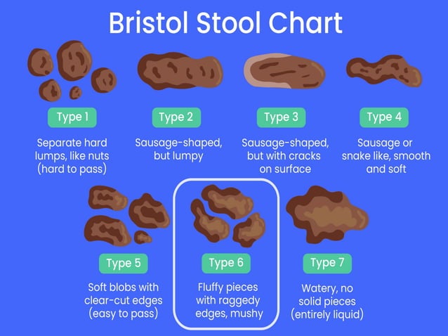 Stool Routine Examination Pptxstool Routine Examination Pptx