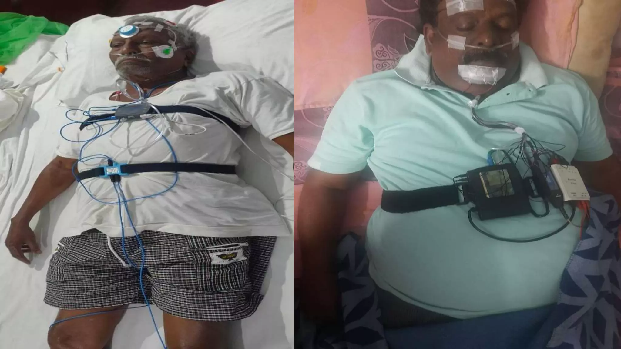 STOP-BANG And Epworth Sleepiness Scale in The Diagnosis.pptx