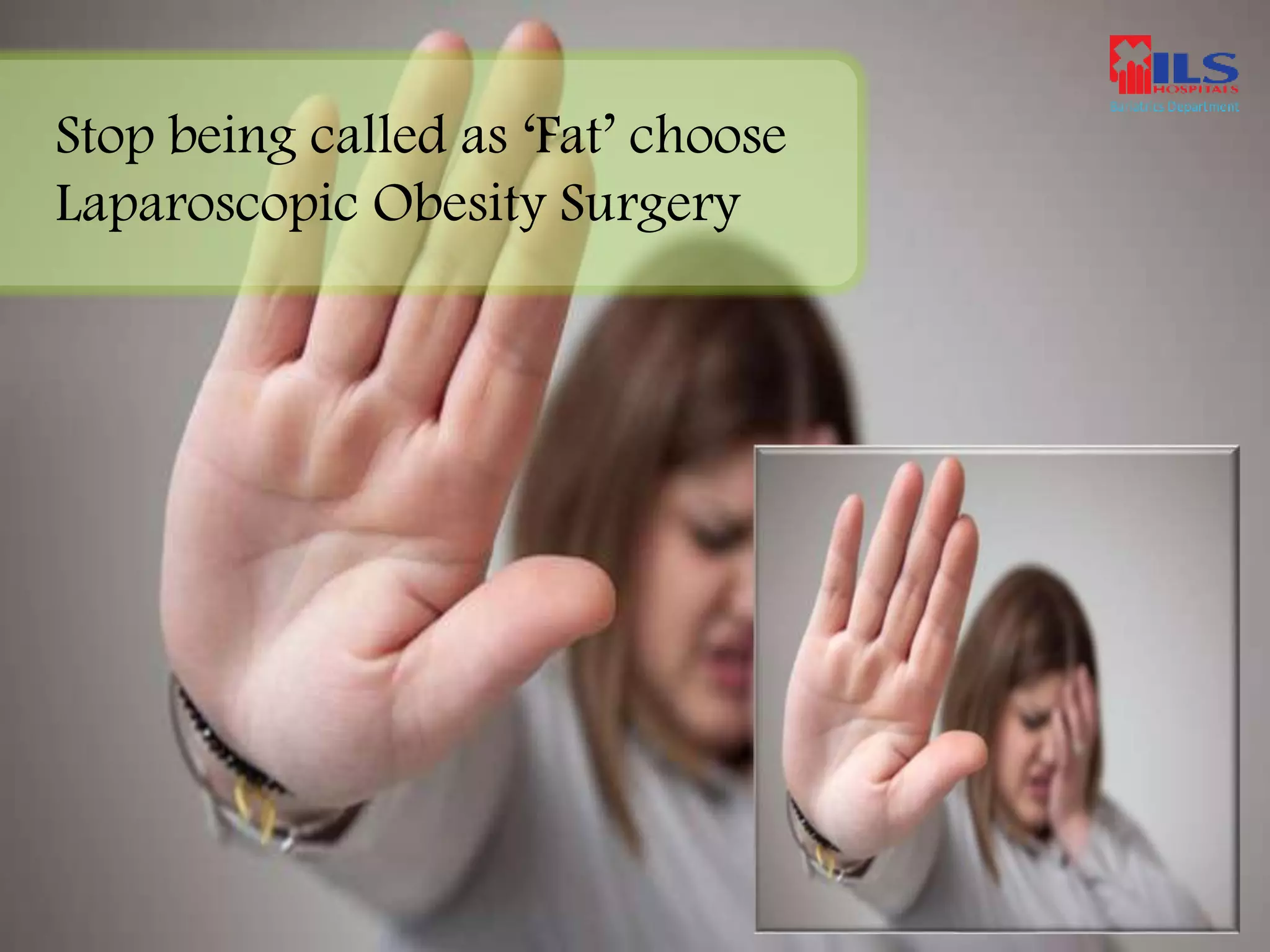 Stop being called as "Fat" - Choose Laparoscopic Obesity Surgery to ...