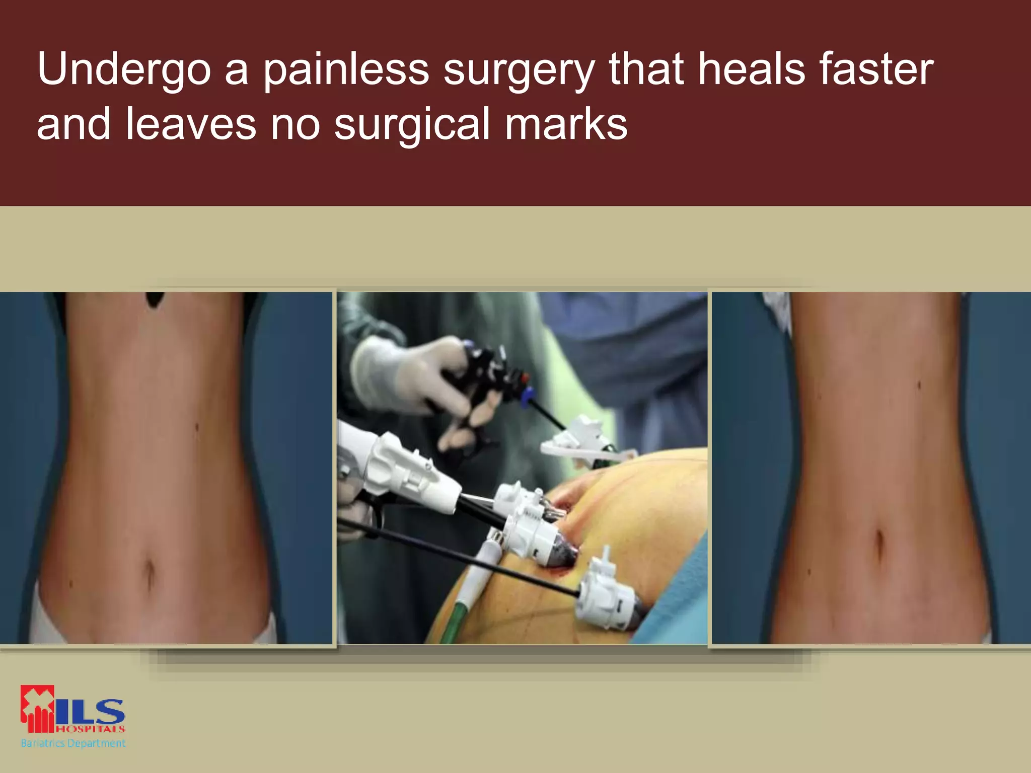 Stop being called as "Fat" - Choose Laparoscopic Obesity Surgery to ...