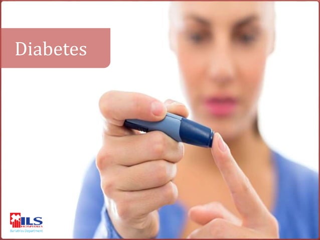 Stop being called as "Fat" - Choose Laparoscopic Obesity Surgery to ...