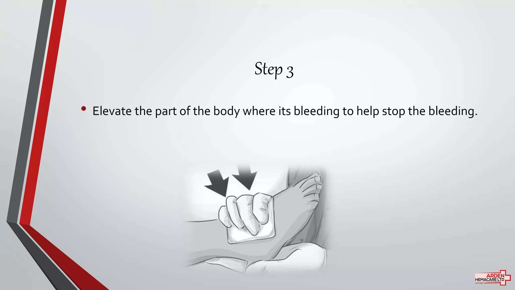 Stop bleeding | PPTX