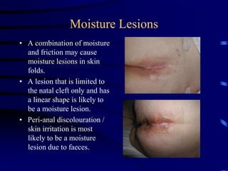 Stop the Pressure Lincoln - 15 October 2013 | PPT