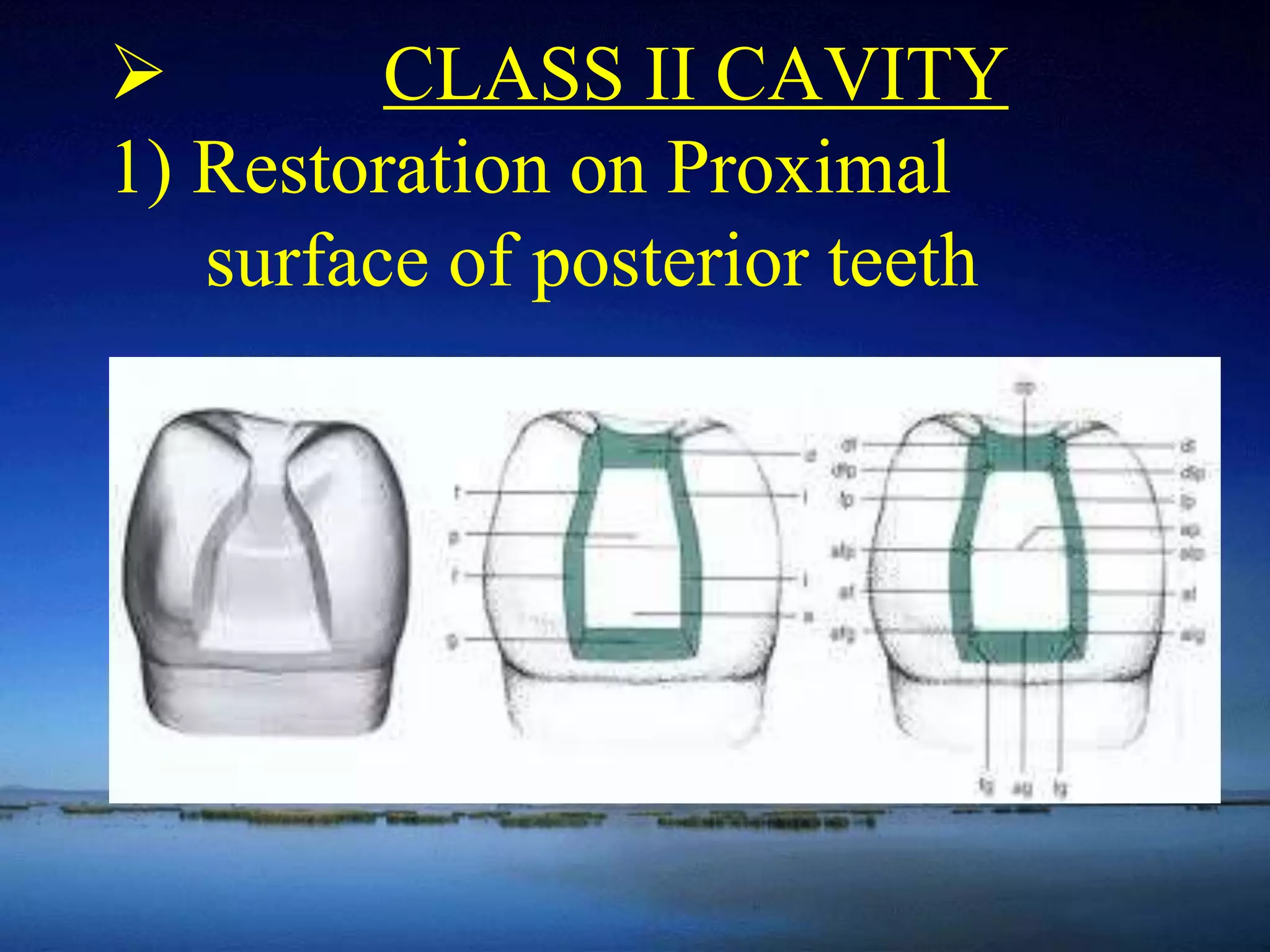 Principles of cavity preparation by Dr .rupali | PPT