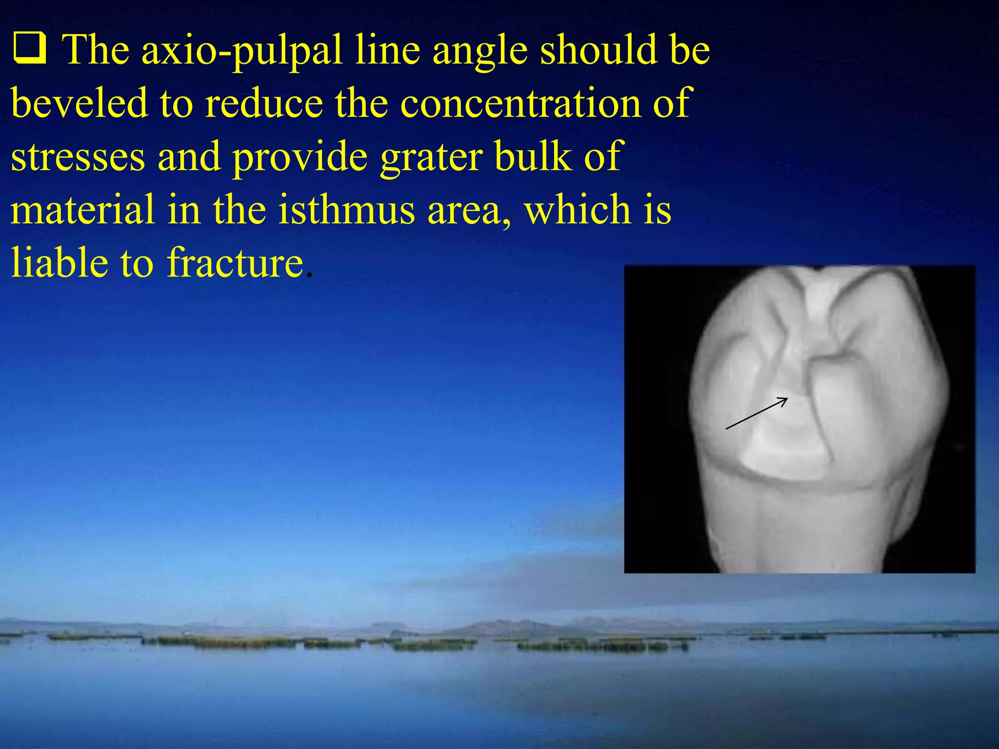 Principles of cavity preparation by Dr .rupali | PPT