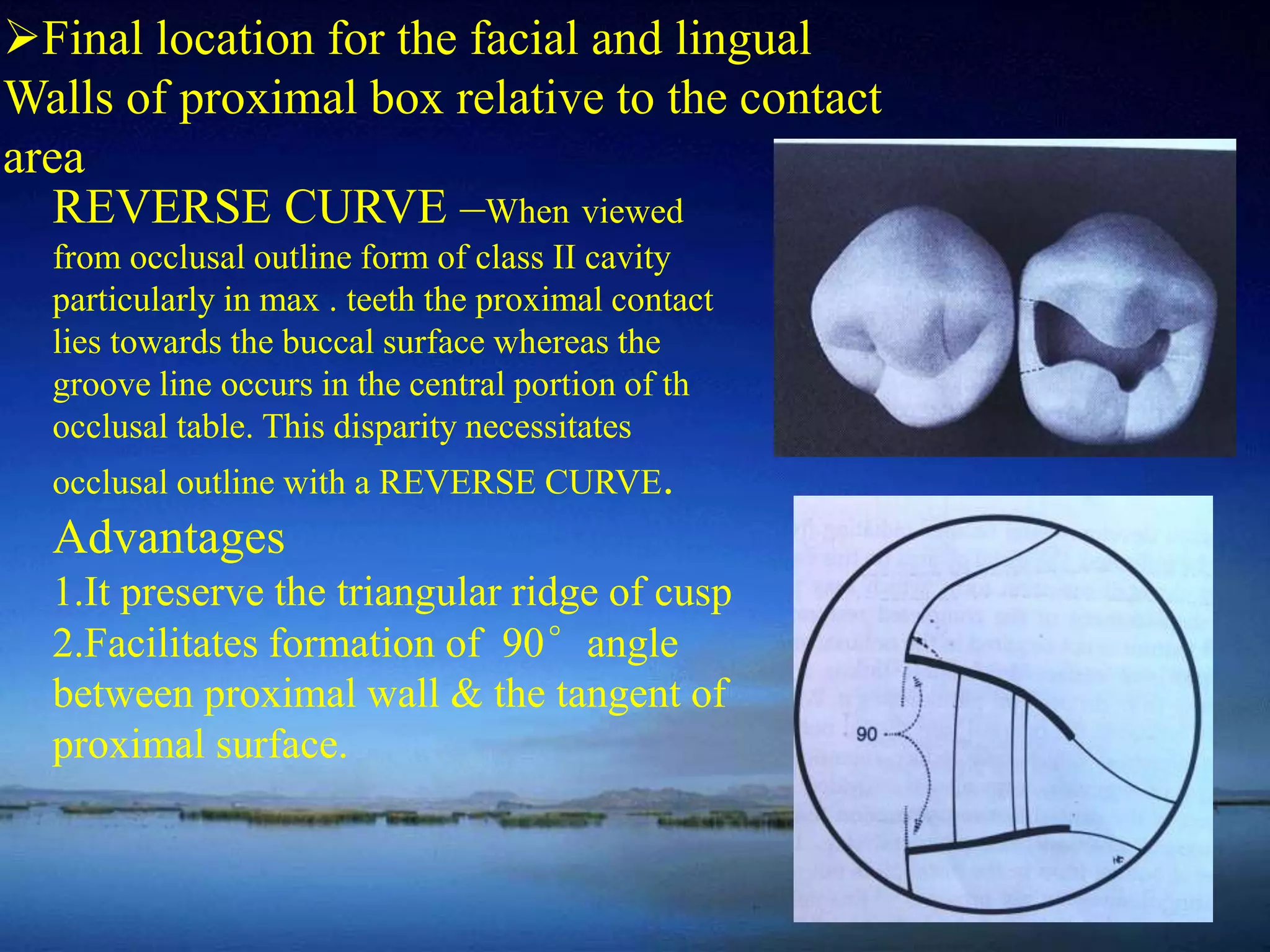 Principles of cavity preparation by Dr .rupali | PPT