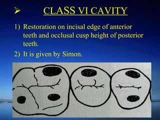 Principles of cavity preparation by Dr .rupali | PPT