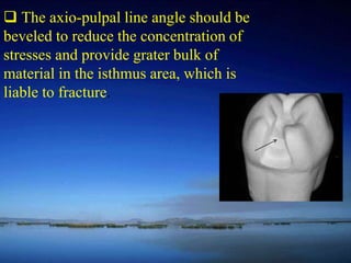 Principles of cavity preparation by Dr .rupali | PPT