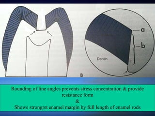 Principles of cavity preparation by Dr .rupali | PPT
