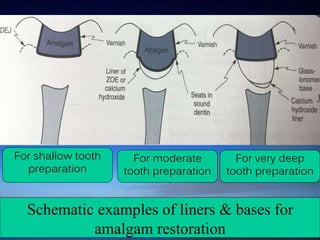 Principles of cavity preparation by Dr .rupali | PPT