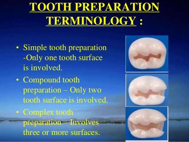 Principles of cavity preparation by Dr .rupali