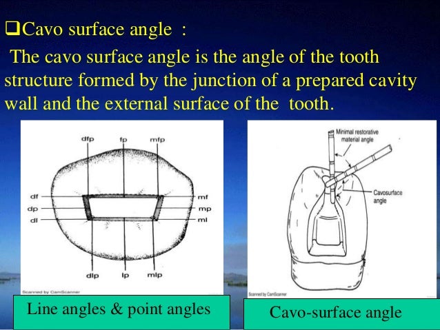 Principles of cavity preparation by Dr .rupali
