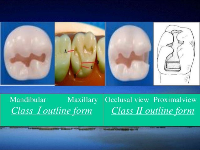 Principles of cavity preparation by Dr .rupali