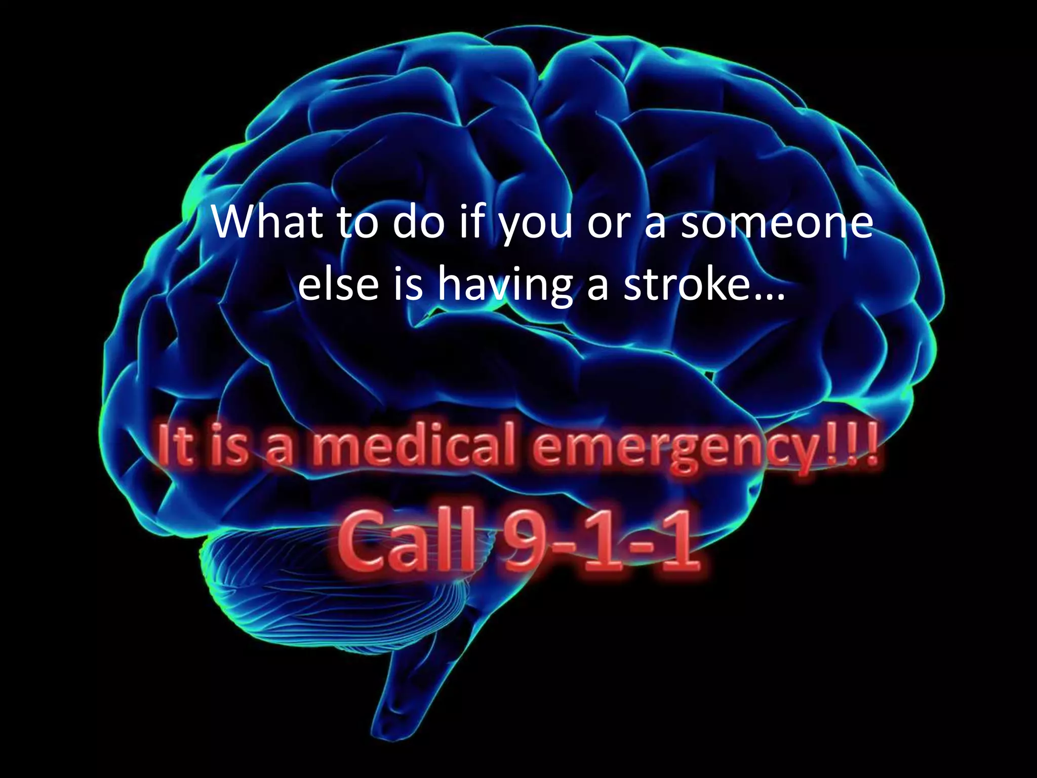 Stroke Ppt