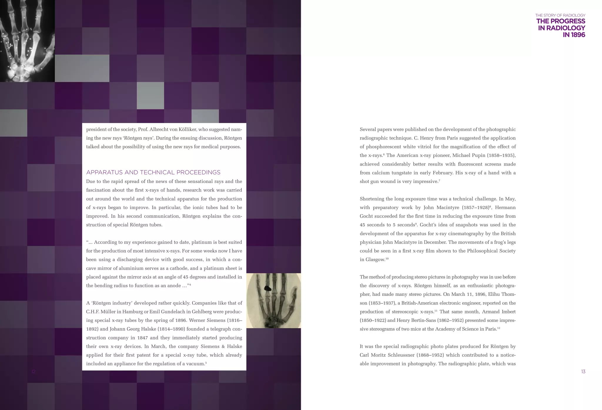 Historia de la Radiología 2 | PDF