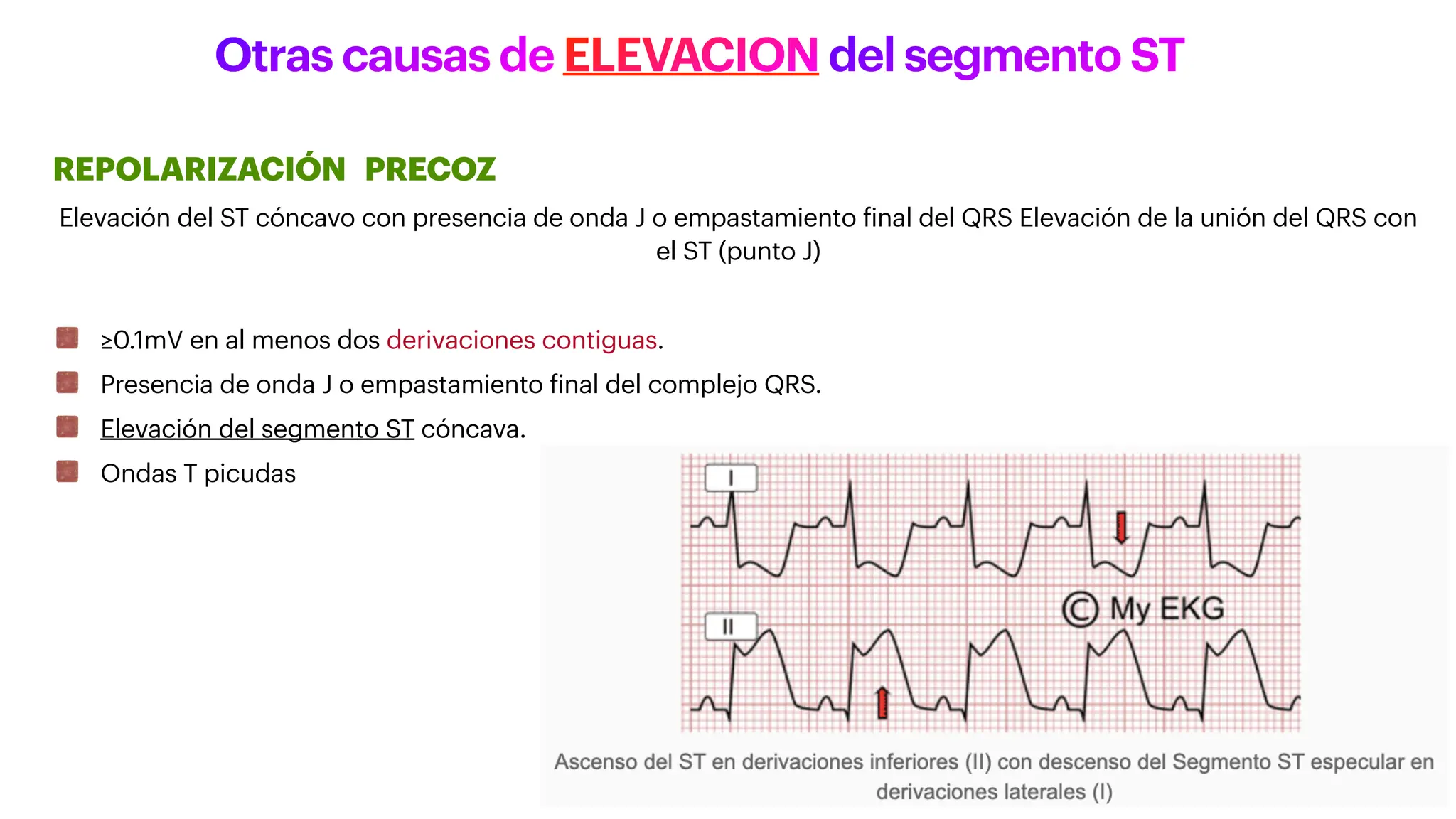 Alteraciones del segmento ST electrocardiograficamante | PDF | Heart ...