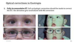 Optical management of strabismus.pptx | Eye and Vision Conditions ...