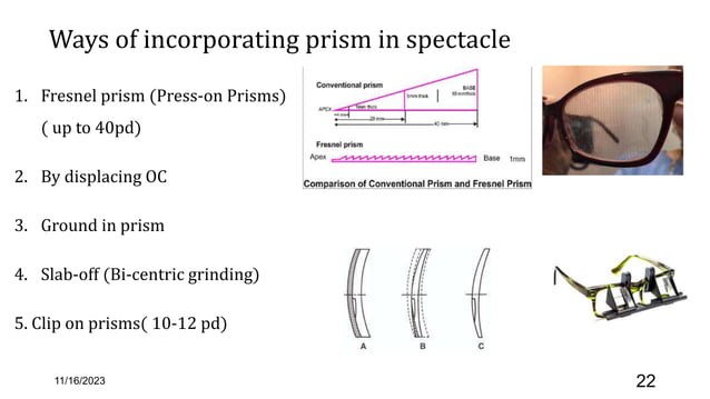 Optical management of strabismus.pptx | Eye and Vision Conditions ...