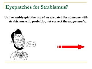 Strabismus | PPT | Eye and Vision Conditions | Diseases and Conditions